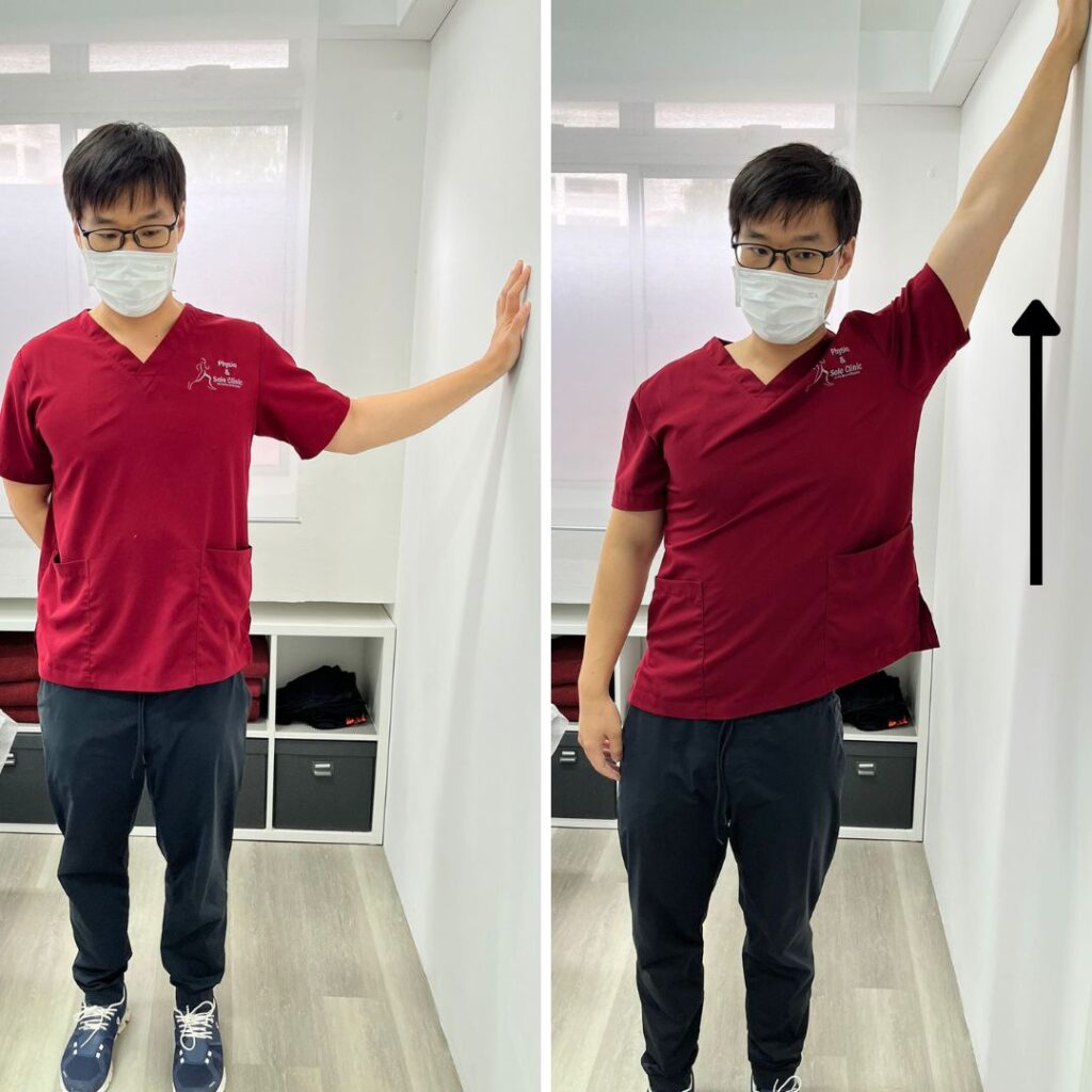 Easy Exercises for Frozen Shoulder