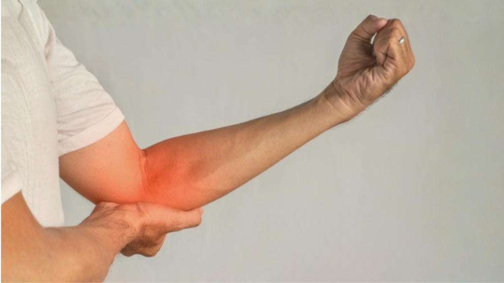Elbow Dislocation Treatment & Recovery Guide for Active Adults | Physio ...
